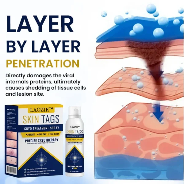 LAOZIK™ Skin Tag Cryo Treatment Spray - Laozik